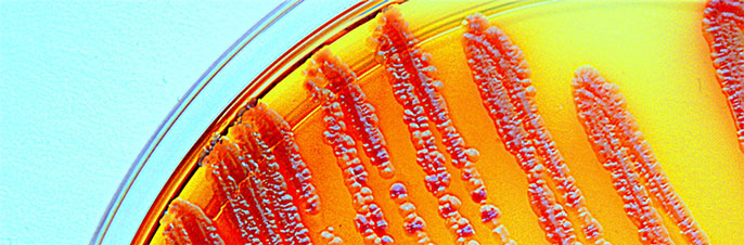 An E. Coli Detector May Be in Your Hands Soon | College of Biological ...